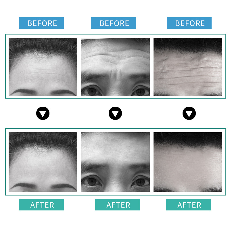 Forehead light pattern paste - iShop Today